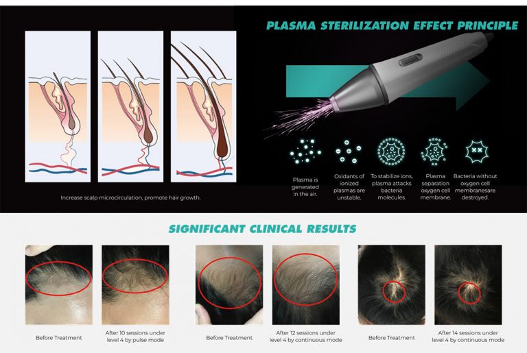 the first fractional and cold plasma platform device in the world ...